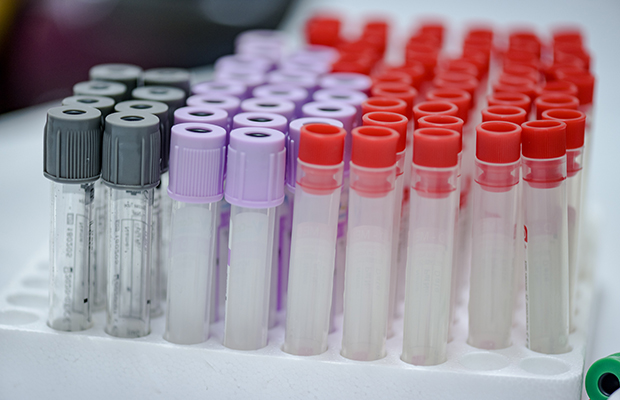 What happens during a blood test and what can the results show? - BHF