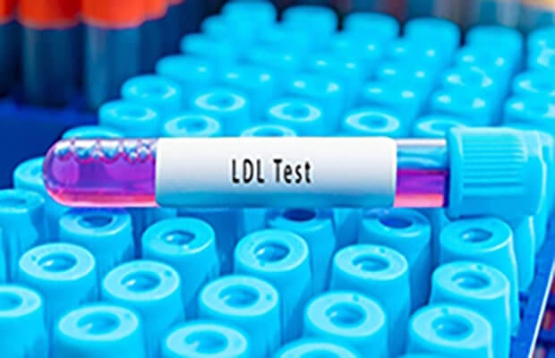 Inclisiran: What you need to know about this cholesterol-lowering drug ...