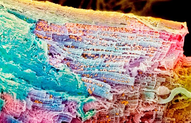 Heart Matters Magazine - BHF