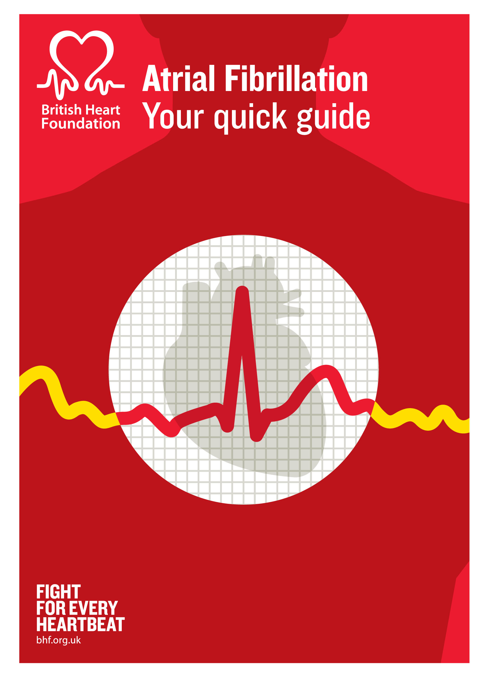 Atrial fibrillation (AF) - BHF