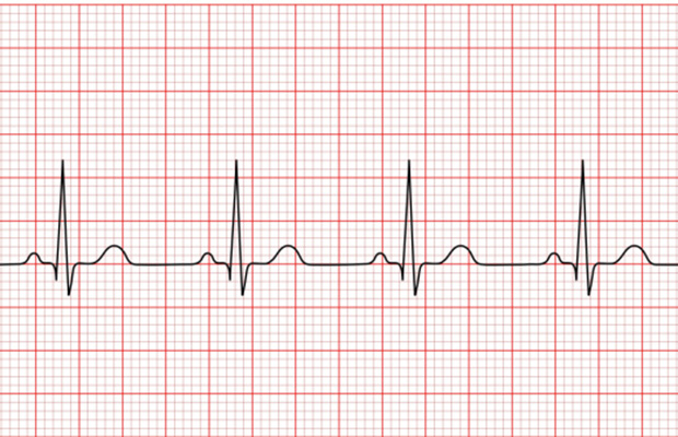 Electrocardiogram (ECG) test | BHF - BHF