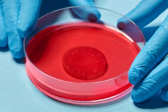 Our research | Heart and Circulatory Disease - BHF