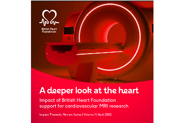 Our research successes - BHF