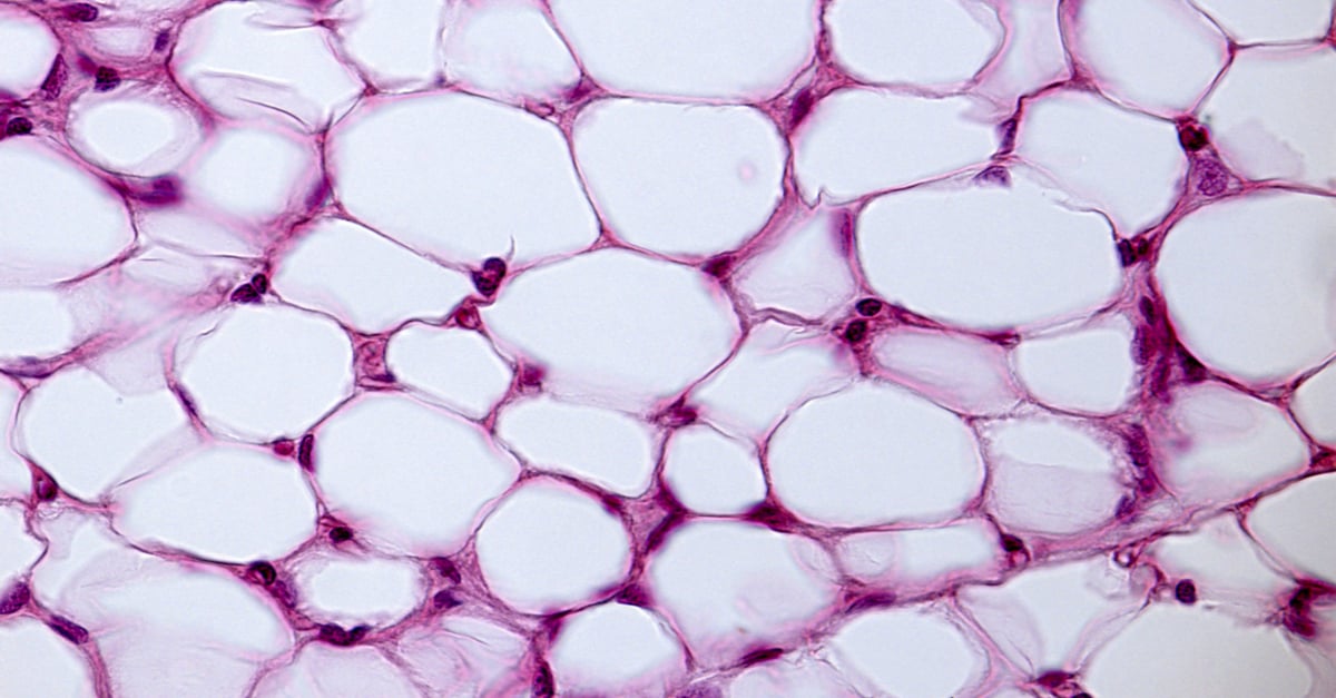 Research links eating a large meal to detection of metabolic diseases - BHF