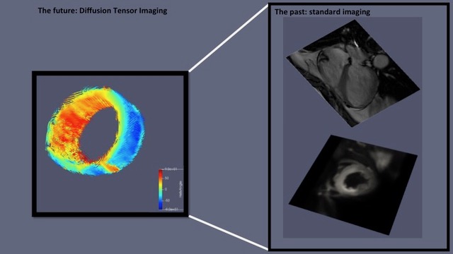 Leeds research could see new approach to treating heart attack patients