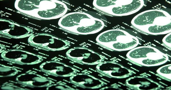 Architecture of the heart different between women and men and with age ...