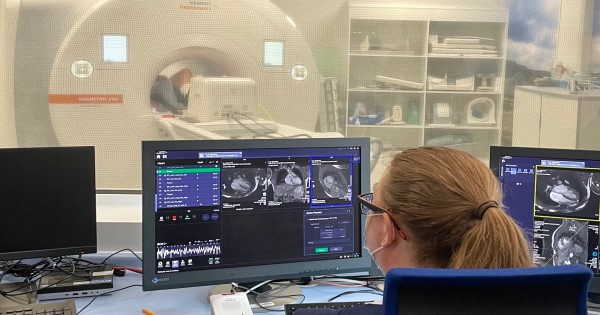 New MRI scanner facility opens in Leicester - BHF