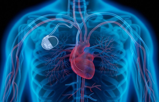 Remote heart alert system saves heart failure patients from hospitalisation