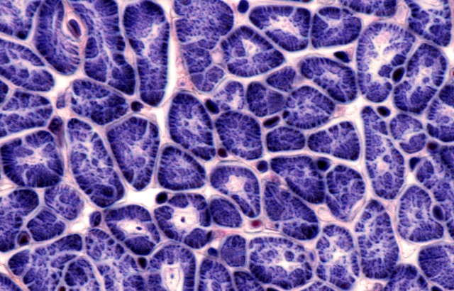 Detailed map of the heart to provide new insights - BHF