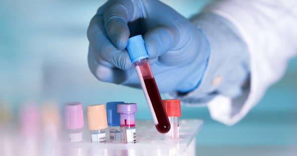 Latest news from the BHF - BHF