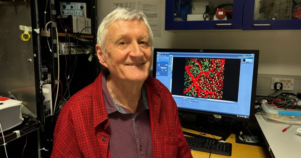 Prof David Attwell to spearhead BHF-UK DRI Centre for Vascular Dementia ...